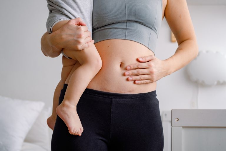 Intip Tanda Infeksi Operasi Caesar Hingga Cara Mengobatinya! – Dr ...